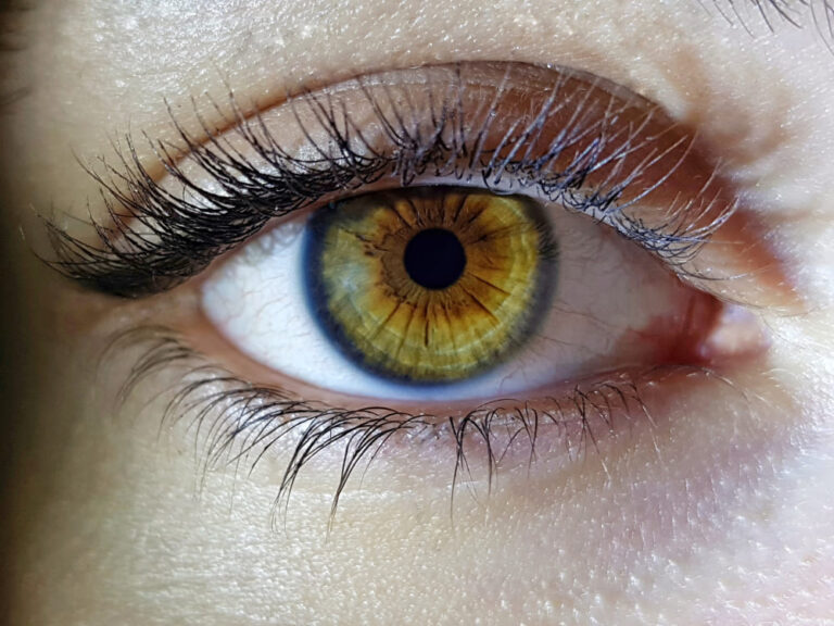 Birthmark on Eye Meaning (Spiritual): Right and Left Eye