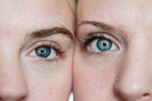 Birthmark on Eye Meaning (Spiritual): Right and Left Eye