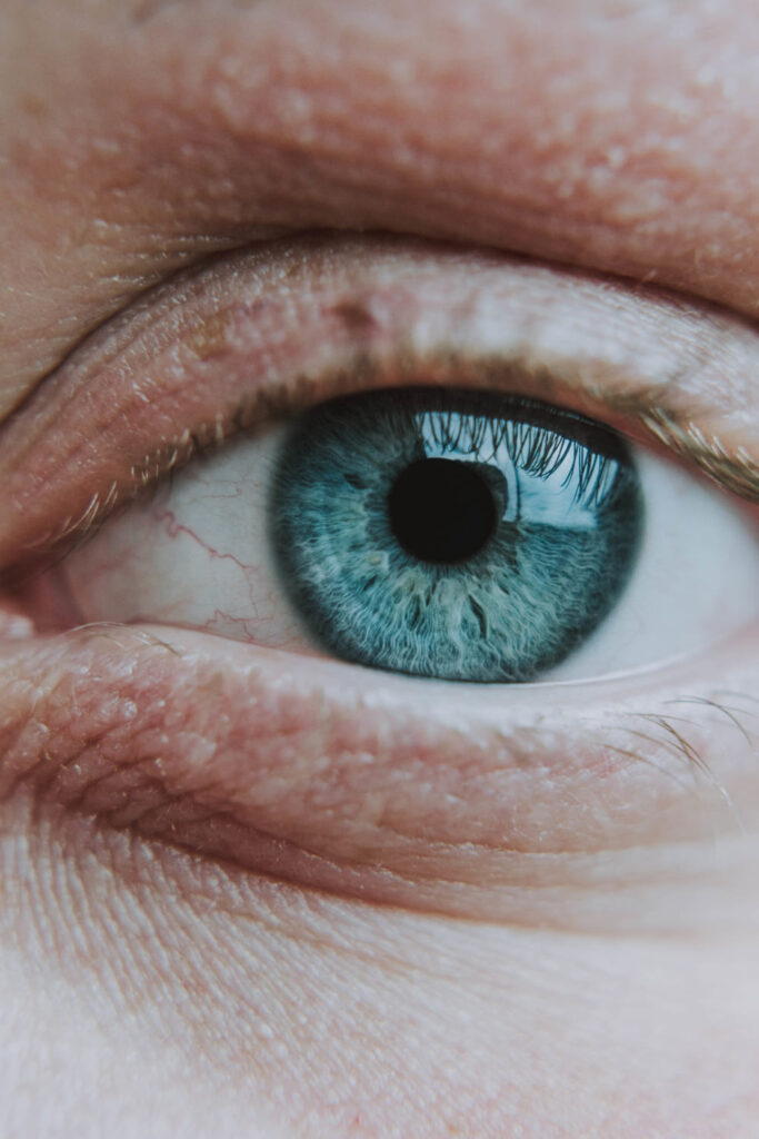 Birthmark on Eye Meaning (Spiritual): Right and Left Eye