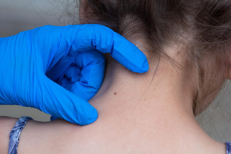 Mole on Neck Meaning: 7 Spiritual Signs For You