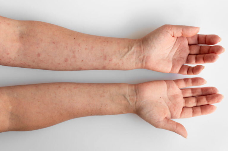 Moles on Left and Right Hand Meaning: 7 Spiritual Signs